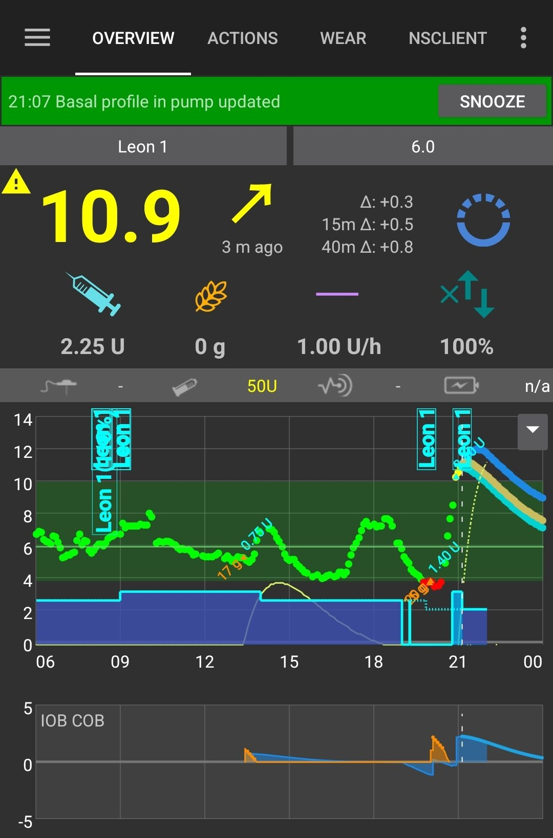 Finding My Basal Levels With A CGM (and My Pump Settings) – The ...